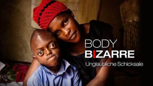 Jetzt ansehen Body Bizarre - Unglaubliche Schicksale | Staffel 5 Folge ...
